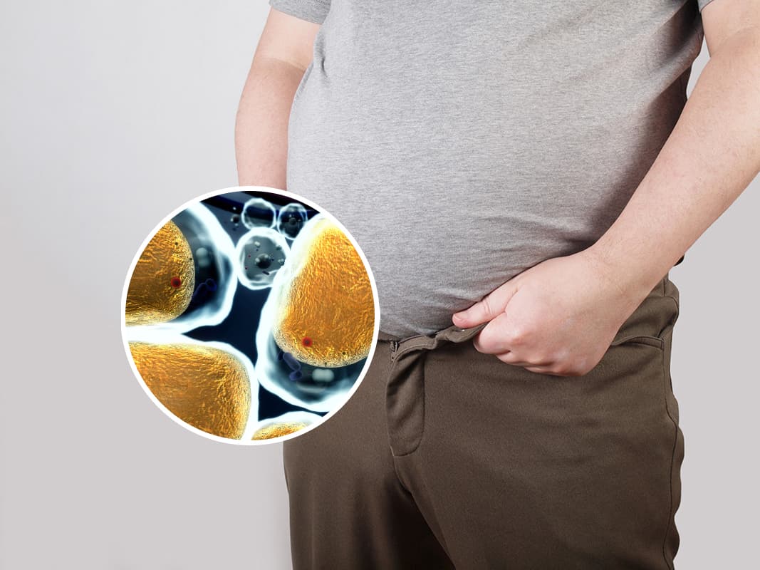 Fat Belly In Spanish Slang at Dean Metoyer blog